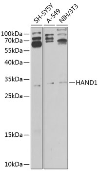 HAND1 Antibody - Cat. No. 23-944 | ProSci