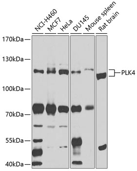 PLK4 Antibody - Cat. No. 23-947 | ProSci