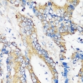ELP3 Antibody - Cat. No. 23-954 | ProSci