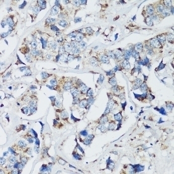 ELP3 Antibody - Cat. No. 23-954 | ProSci