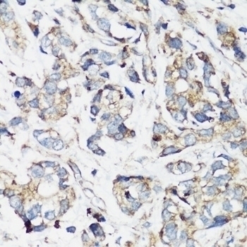 ELP3 Antibody - Cat. No. 23-954 | ProSci
