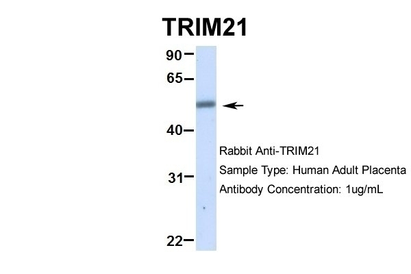 TRIM21 Antibody - Cat. No. 25-186 | ProSci