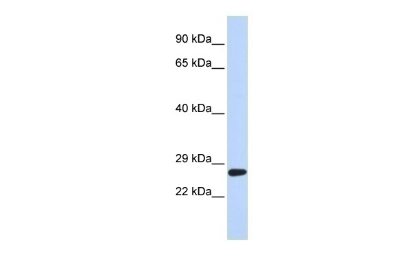 SETD4 Antibody - Cat. No. 25-213 | ProSci