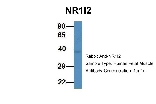 NR1I2 Antibody - Cat. No. 25-312 | ProSci
