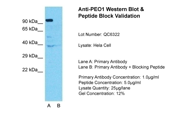 PEO1 Antibody - Cat. No. 25-360 | ProSci