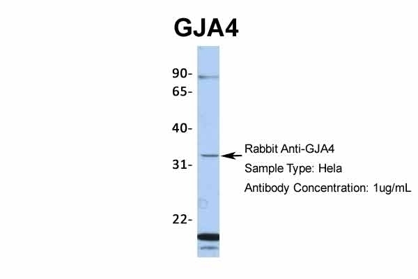 GJA4 Antibody - Cat. No. 25-368 | ProSci