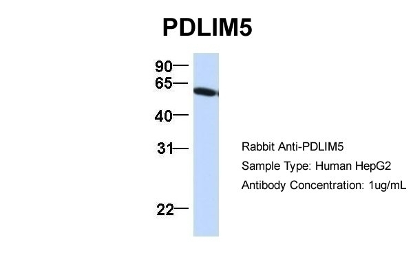 PDLIM5 Antibody - Cat. No. 25-451 | ProSci