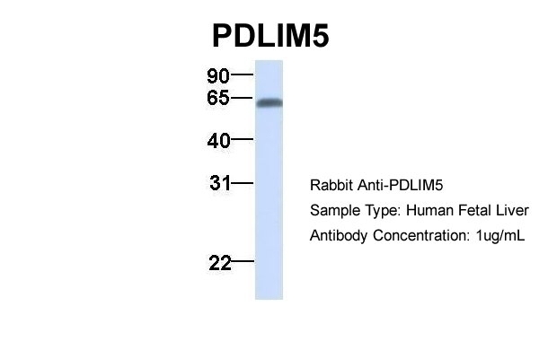 PDLIM5 Antibody - Cat. No. 25-451 | ProSci