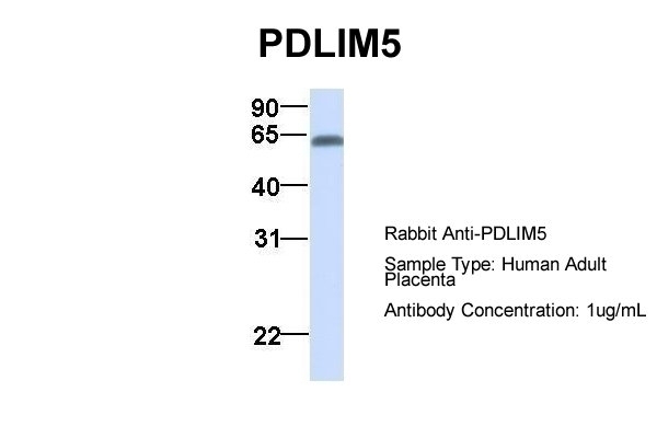 PDLIM5 Antibody - Cat. No. 25-451 | ProSci
