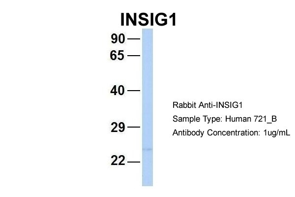 INSIG1 Antibody - Cat. No. 25-589 | ProSci