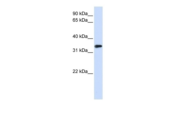 MBD3 Antibody - Cat. No. 25-590 | ProSci