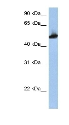 TUBB2A Antibody - Cat. No. 25-591 | ProSci