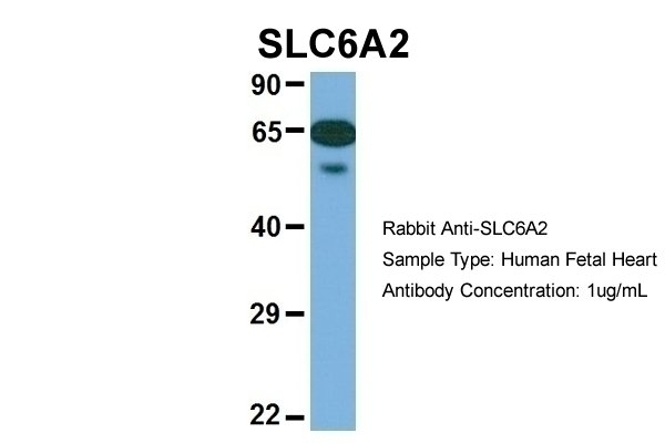 SLC6A2 Antibody - Cat. No. 25-729 | ProSci