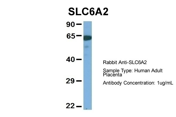 SLC6A2 Antibody - Cat. No. 25-729 | ProSci