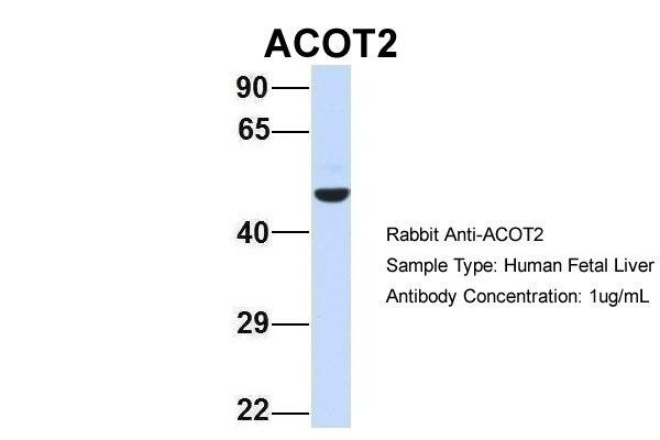 ACOT2 Antibody - Cat. No. 25-757 | ProSci
