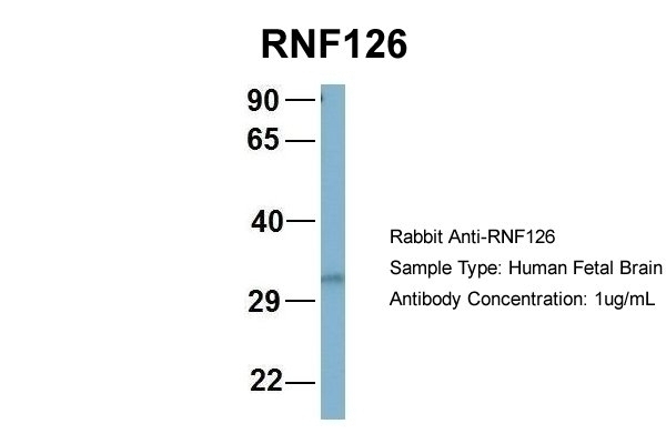 RNF126 Antibody - Cat. No. 25-836 | ProSci