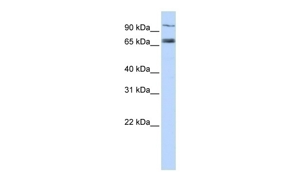 TAP1 Antibody - Cat. No. 25-880 | ProSci