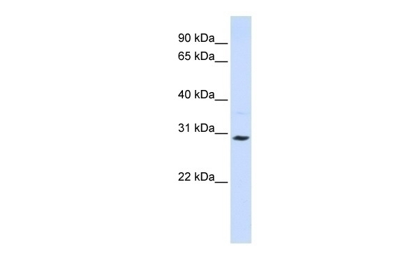 SLC25A20 Antibody - Cat. No. 25-888 | ProSci