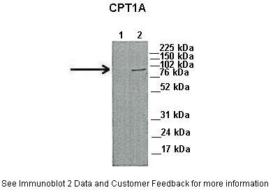CPT1A Antibody - Cat. No. 26-009 | ProSci