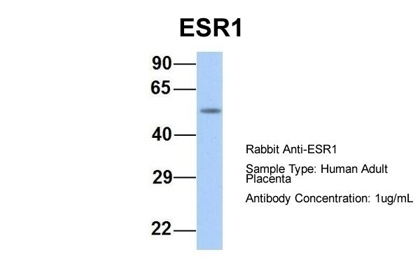 ESR1 Antibody - Cat. No. 26-058 | ProSci