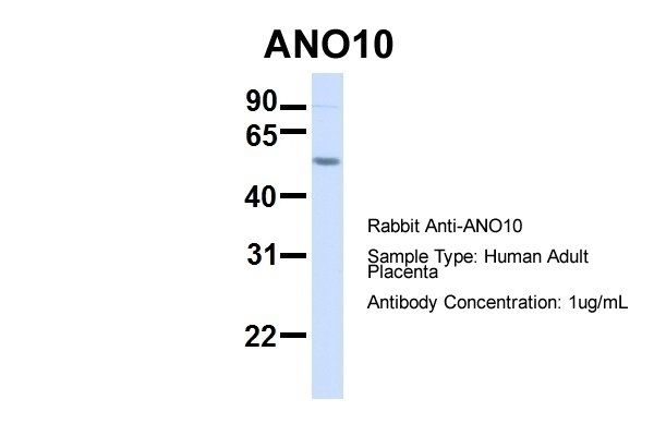 TMEM16K Antibody - Cat. No. 26-220 | ProSci