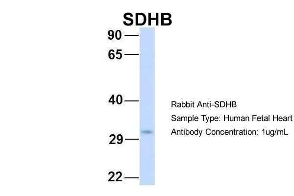 SDHB Antibody - Cat. No. 26-268 | ProSci