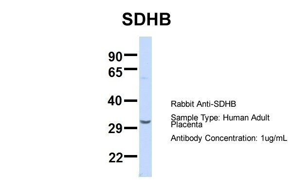 SDHB Antibody - Cat. No. 26-268 | ProSci