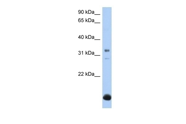 B3GALT6 Antibody - Cat. No. 26-502 | ProSci