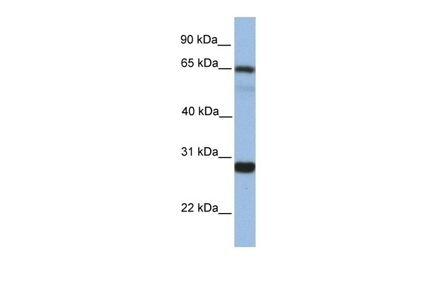 MED4 Antibody - Cat. No. 26-547 | ProSci