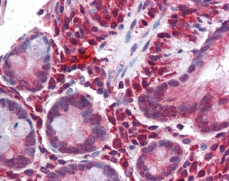 MGP Antibody - Cat. No. 26-600 | ProSci