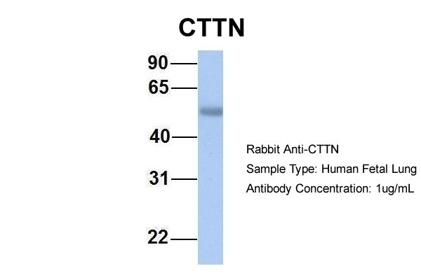 CTTN Antibody - Cat. No. 26-630 | ProSci