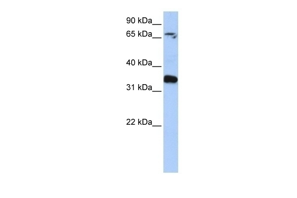 GLE1 Antibody - Cat. No. 26-893 | ProSci