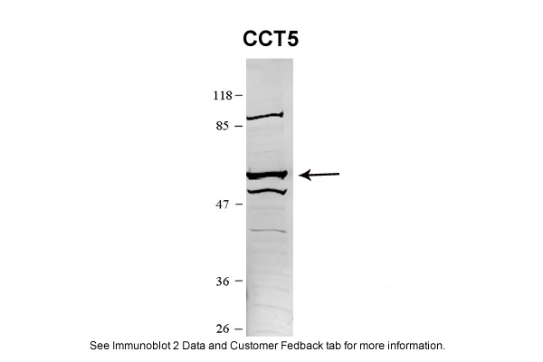 CCT5 Antibody - Cat. No. 26-932 | ProSci