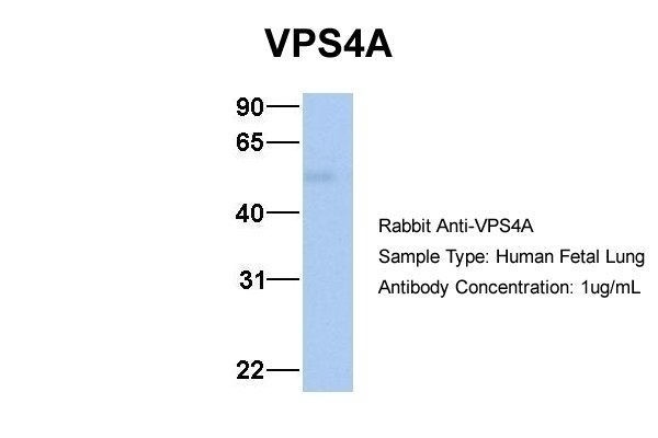 VPS4A Antibody - Cat. No. 26-947 | ProSci