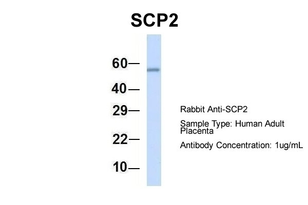 SCP2 Antibody - Cat. No. 27-090 | ProSci