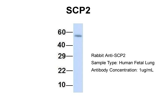 SCP2 Antibody - Cat. No. 27-090 | ProSci