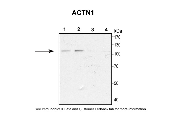 Actin alpha 1 Antibody - Cat. No. 27-160 | ProSci