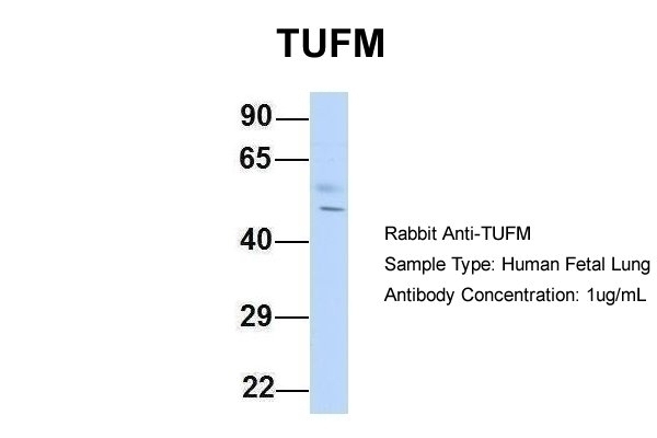 TUFM Antibody - Cat. No. 27-185 | ProSci