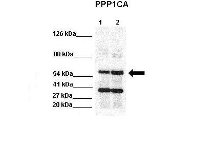 PPP1CA Antibody - Cat. No. 27-205 | ProSci