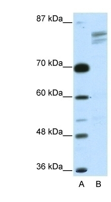 GTF2I Antibody - Cat. No. 27-438 | ProSci