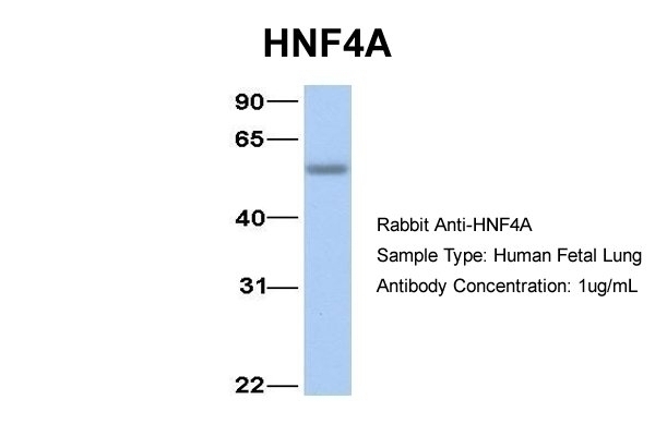 HNF4A Antibody - Cat. No. 27-452 | ProSci