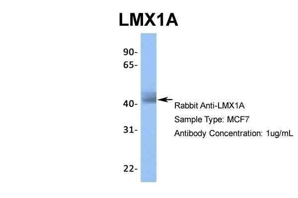LMX1A Antibody - Cat. No. 27-471 | ProSci