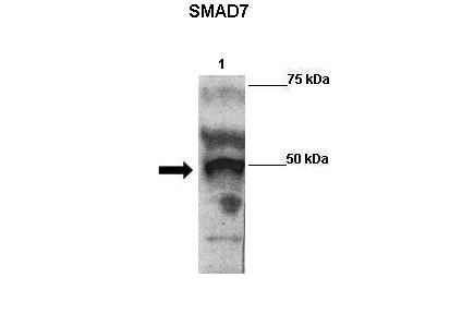 SMAD7 Antibody - Cat. No. 27-477 | ProSci