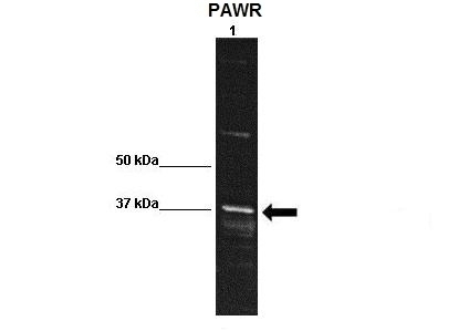 PAWR Antibody - Cat. No. 27-492 | ProSci
