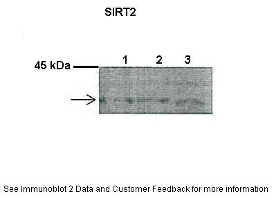 SIRT2 Antibody - Cat. No. 27-575 | ProSci