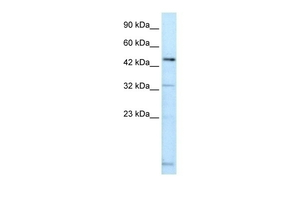 DMRTA2 Antibody - Cat. No. 27-808 | ProSci