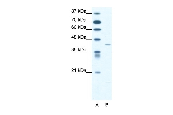 SSTR4 Antibody - Cat. No. 27-838 | ProSci
