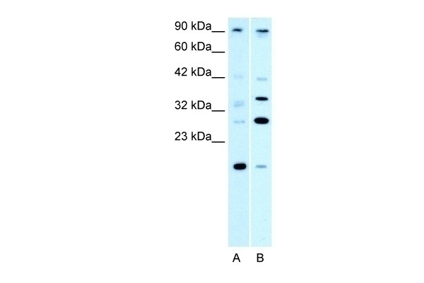 PARP11 Antibody - Cat. No. 27-943 | ProSci