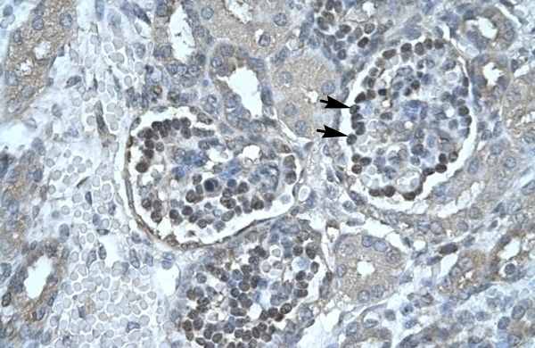 PNLIP Antibody - Cat. No. 27-962 | ProSci