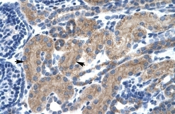 TCF7 Antibody - Cat. No. 28-193 | ProSci